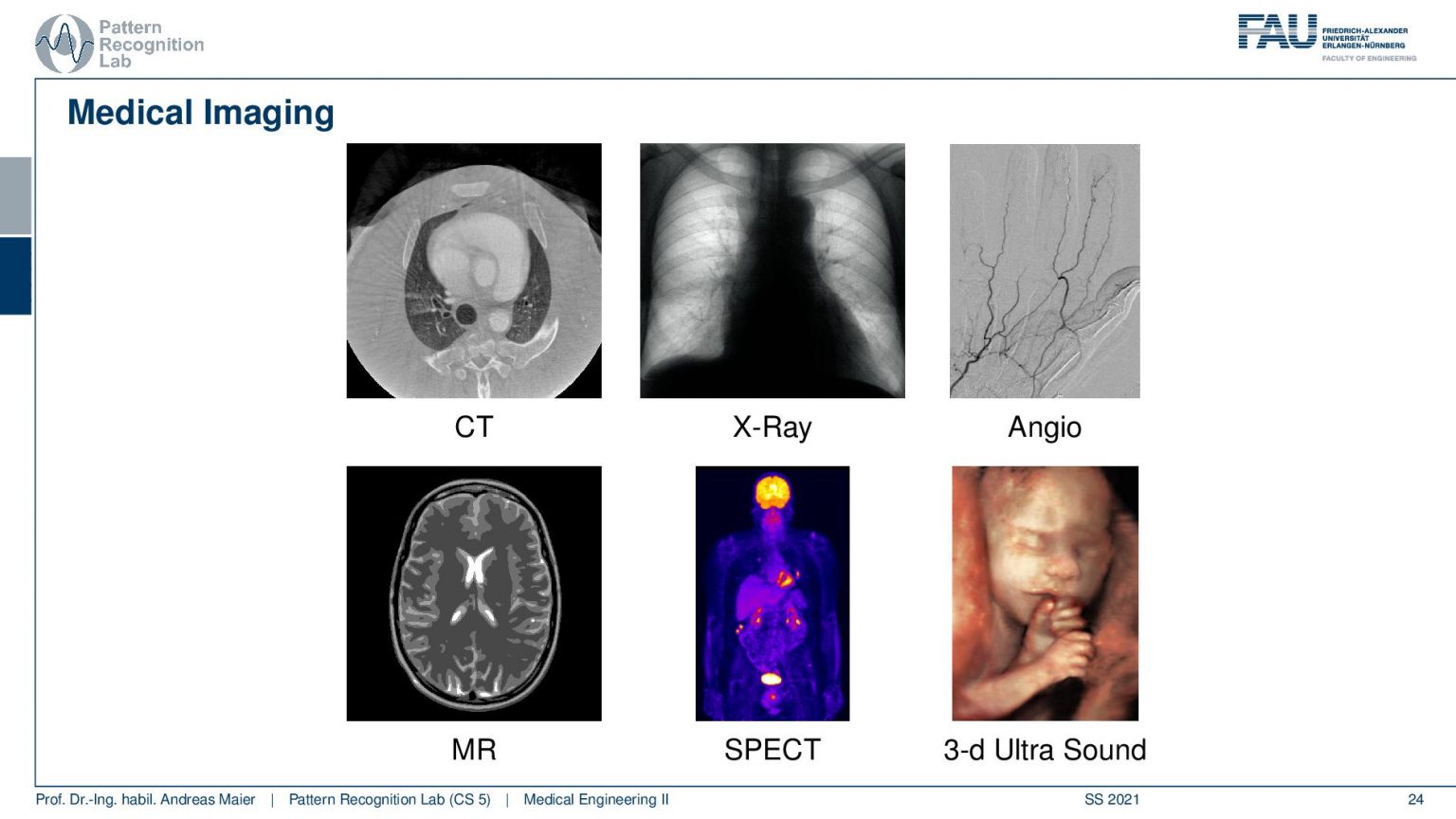 Medical Imaging Systems - Modalities - Part 2 - Pattern Recognition Lab