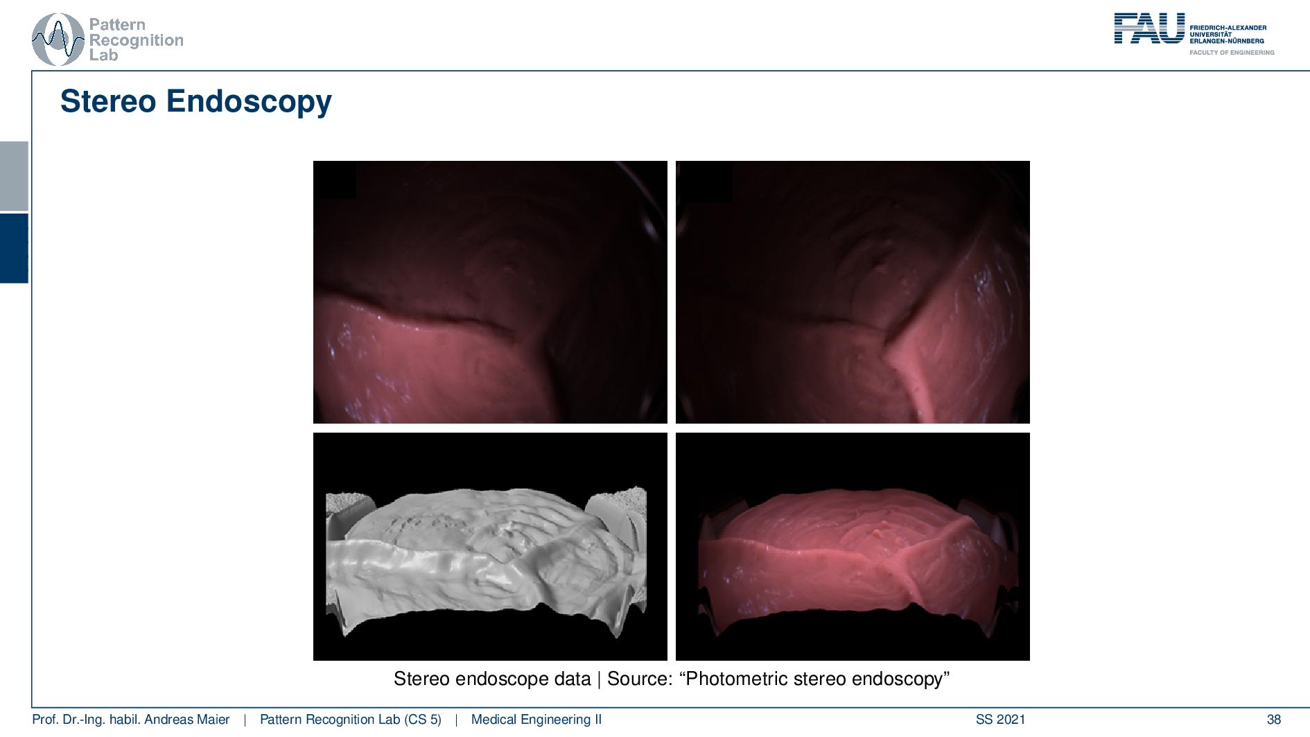 Endoscopy - Part 2 - Pattern Recognition Lab