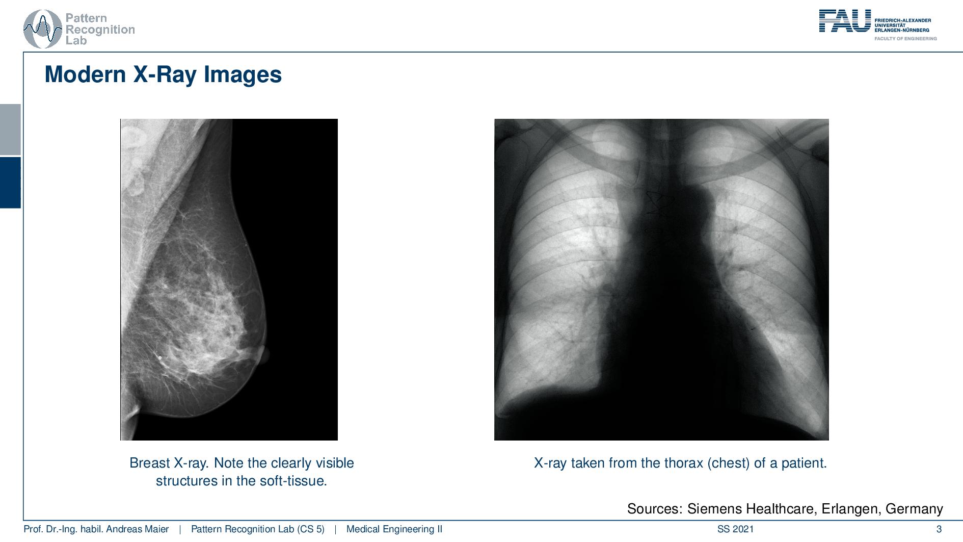 X-ray Generation - Pattern Recognition Lab